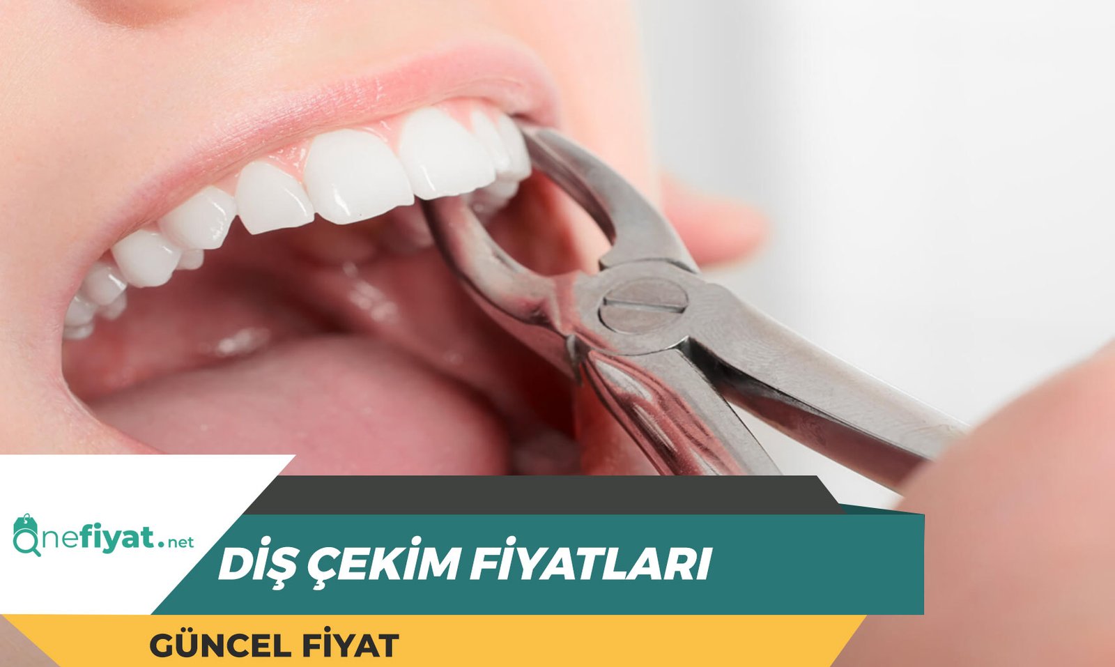 Diş Çekim Fiyatları 2024 | GÜNCEL Diş Çekim Ücretleri!
